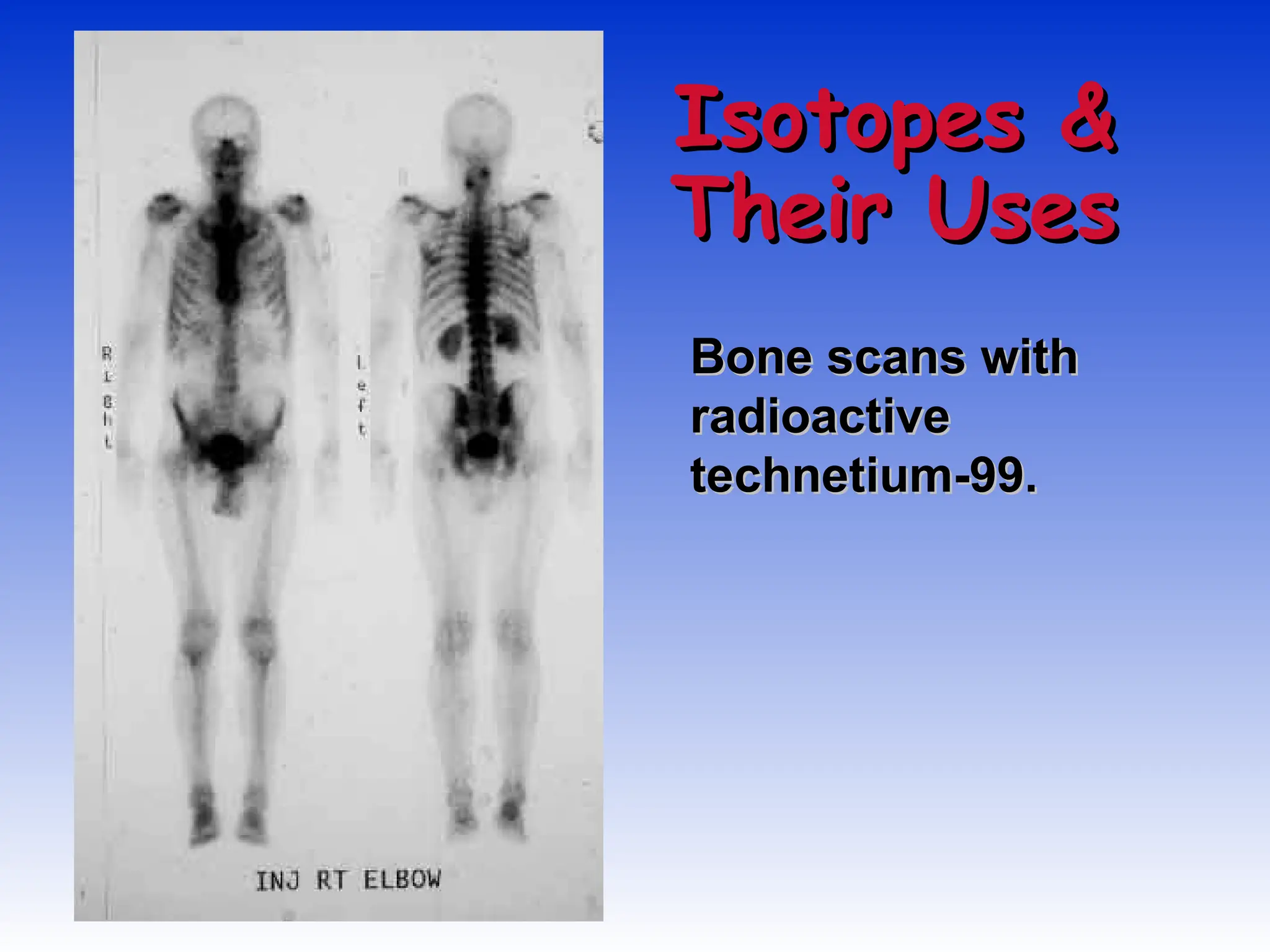notes_isotopes_ions chemistry powerpoint.ppt
