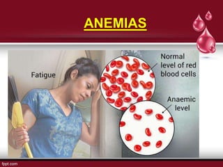 Babitha's Notes on anemia's & bleeding disorders | PPT