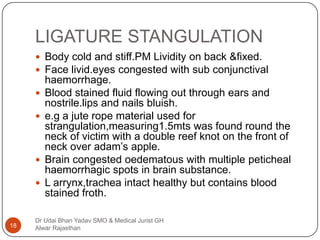 Notes on forensic medicines | PPT