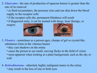 Notes on Senses .ppt
