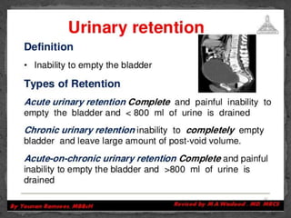Notes on urinary disorders 3 | PPTX