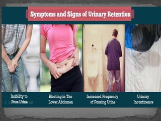 Notes on urinary disorders 3 | PPTX