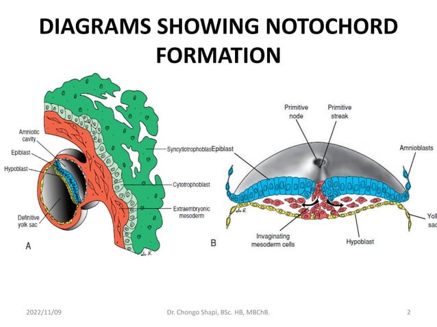 NOTOCHORD, NEURULATION AND NTDs by Shapi. MD.pdf | Pregnancy ...
