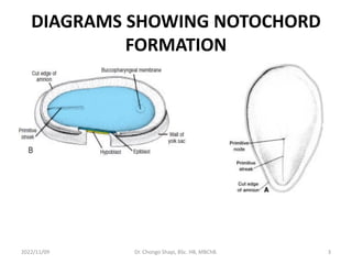 NOTOCHORD, NEURULATION AND NTDs by Shapi. MD.pdf