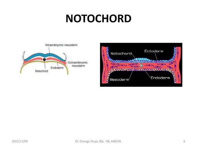 NOTOCHORD, NEURULATION AND NTDs by Shapi. MD.pdf | Pregnancy ...