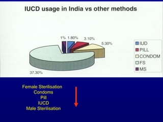 No touch loading technique | PPT | Birth Control | Reproductive Health