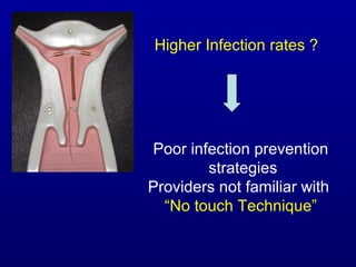 No touch loading technique | PPT | Birth Control | Reproductive Health