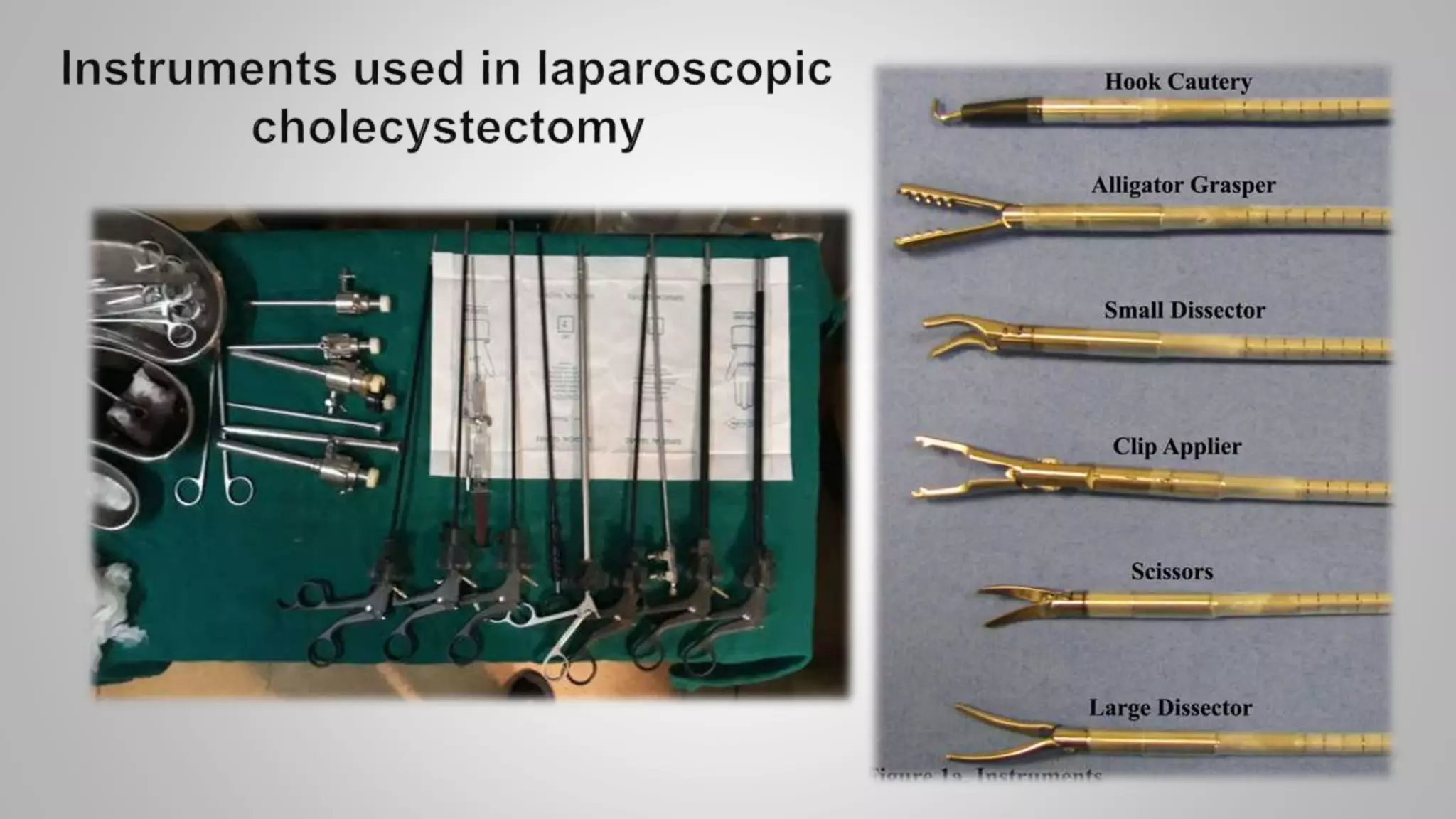 Laparoscpic Cholecystectomy by Dr.nowar | PPTX