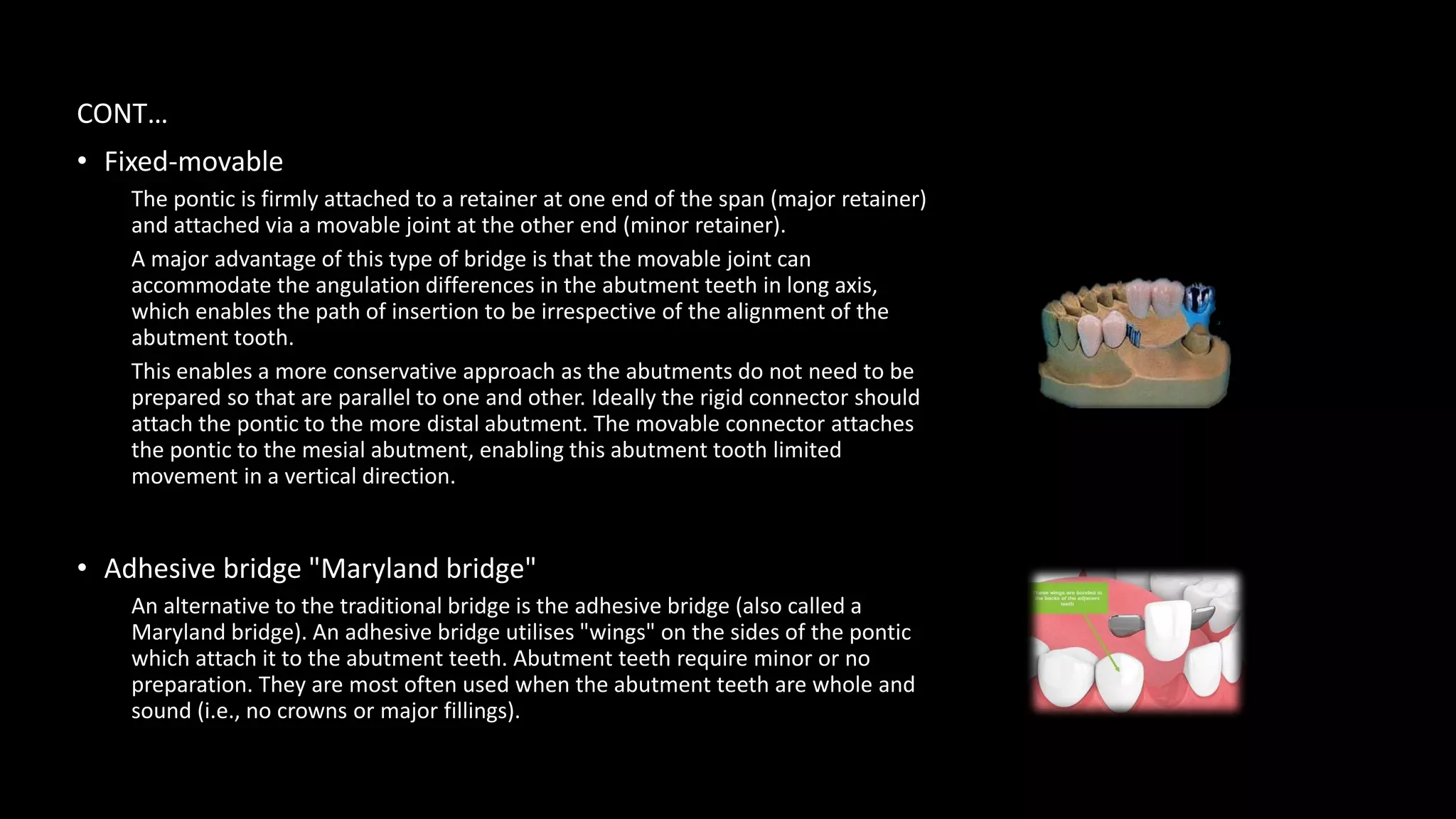 bridge and pontic design lecture | PDF | Dental Health | Diseases and ...