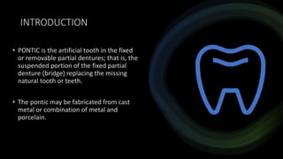 bridge and pontic design lecture | PDF