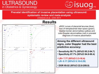 UOG Journal Club: Prenatal identification of invasive placentation ...