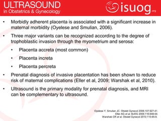 UOG Journal Club: Prenatal identification of invasive placentation ...