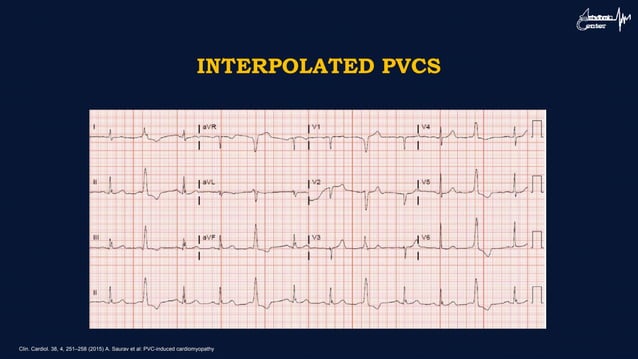 Novel approaches to PVC | PPTX