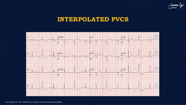 Novel approaches to PVC