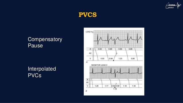 Novel approaches to PVC