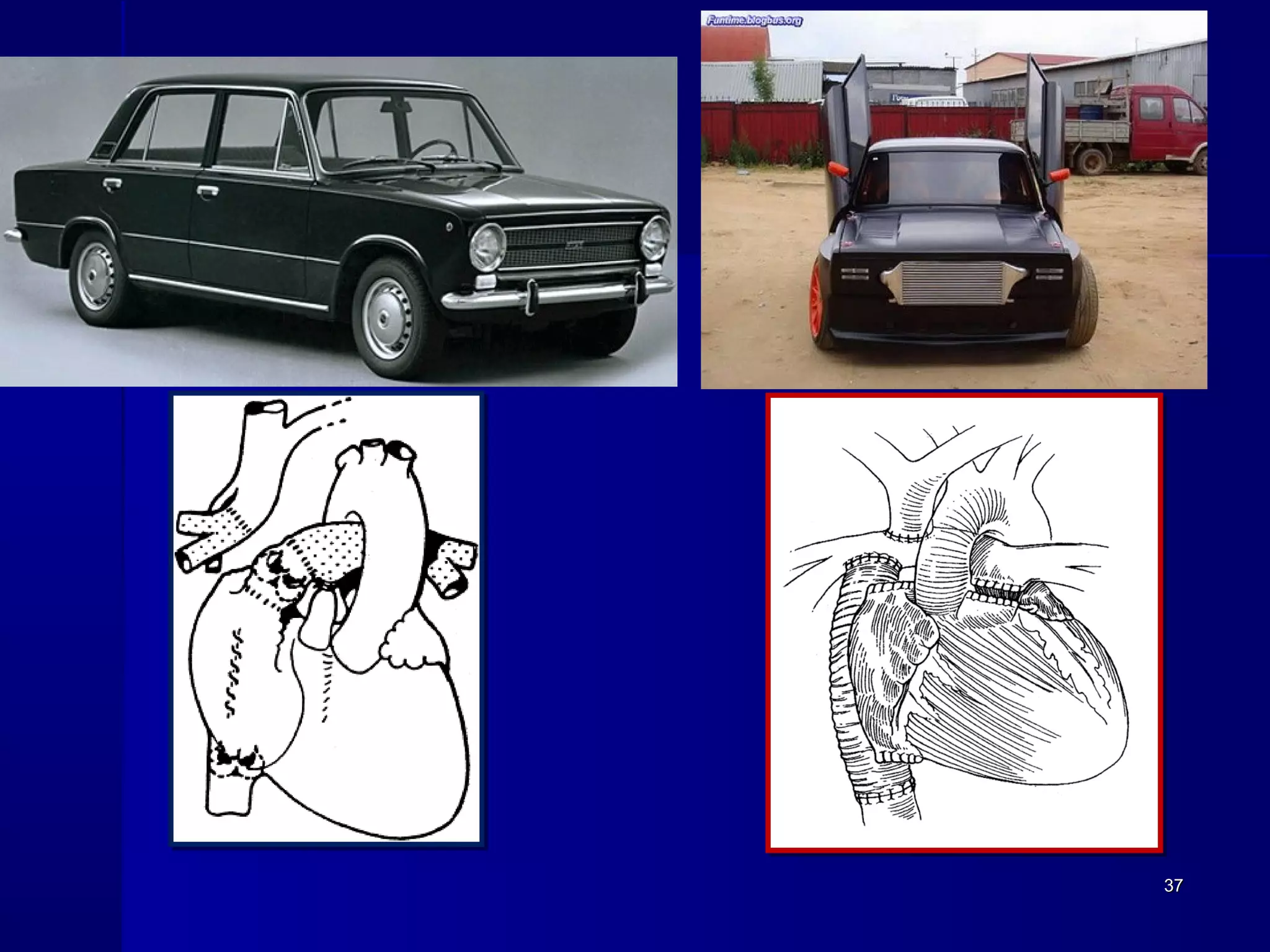 Novel fenestration designs for controlled venous flow shunting in ...