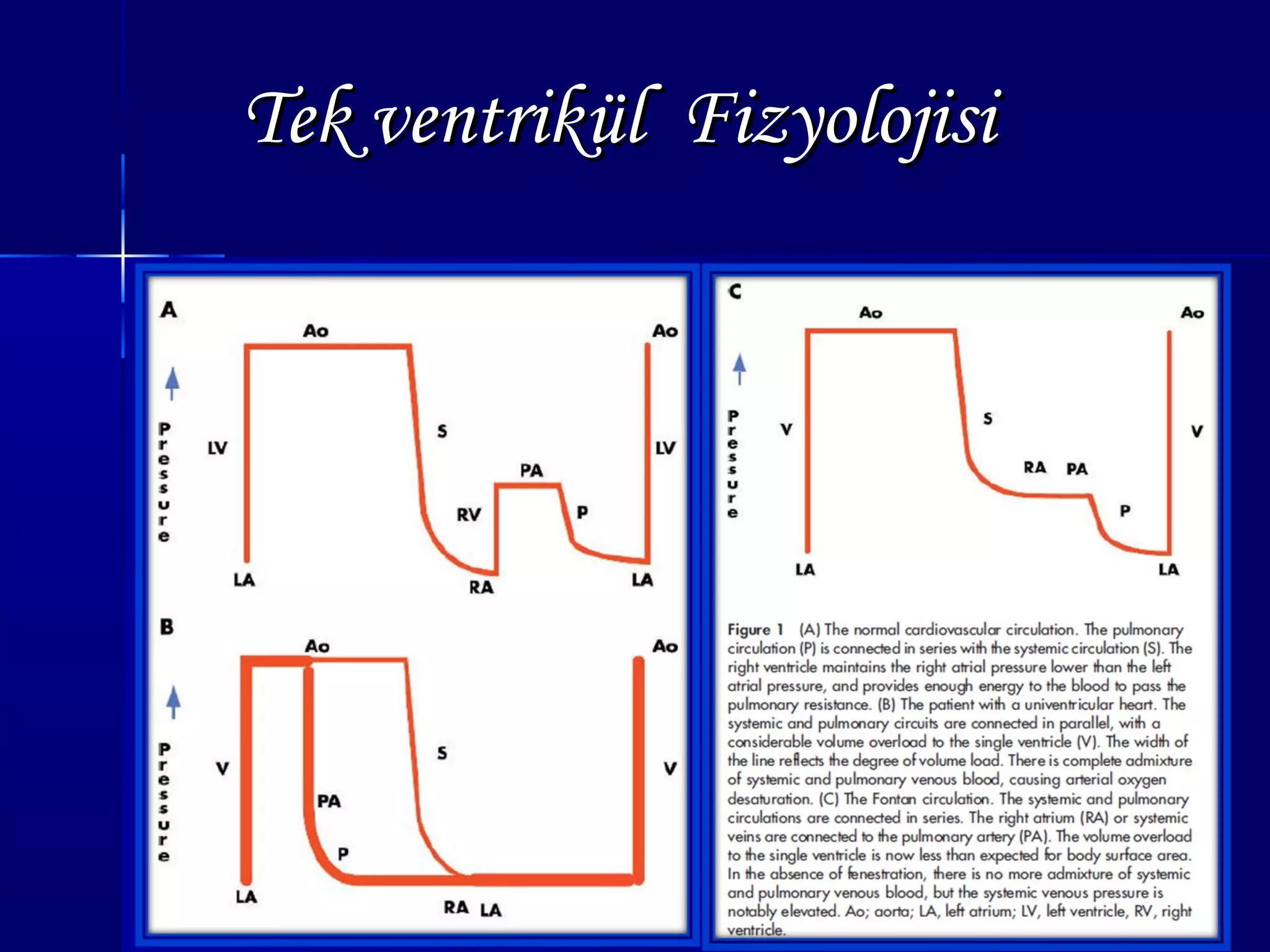 Novel fenestration designs for controlled venous flow shunting in ...