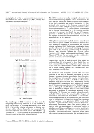 Novel method to find the parameter for noise removal | PDF | Digital Audio | Computer Software ...