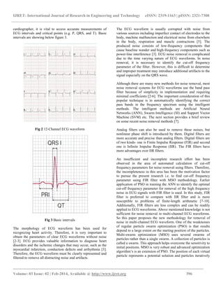 Novel method to find the parameter for noise removal from multi channel ecg waveforms | PDF