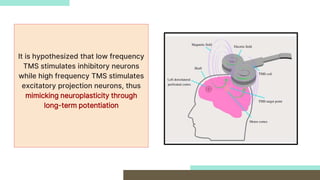 Novel TMS for Stroke and depression.pptx
