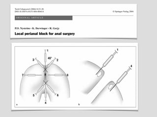 Procedure for prolapse and hemorroids - PPH - | ODP