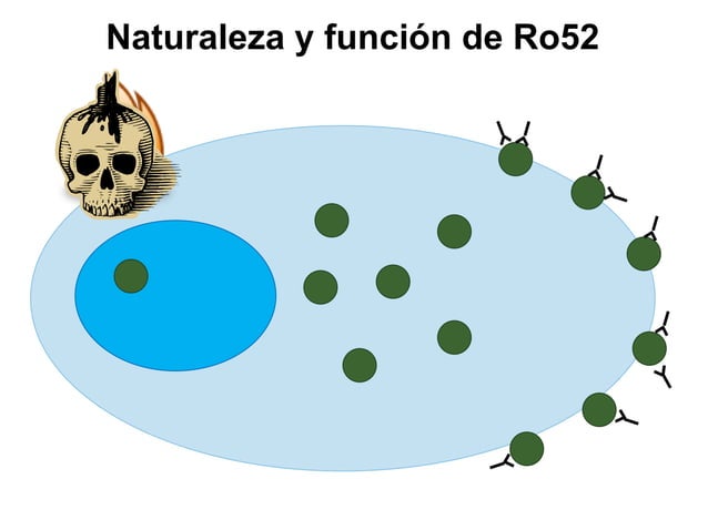 Utilidad pronostica de la determinación de anticuerpos anti-RO-52 en ...