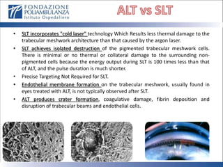 Novita terapia laser glaucoma desenzano 2016 dott nicola canali | PPT