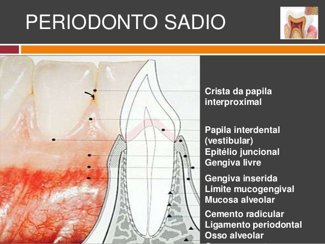 Periodontia em Odontologia