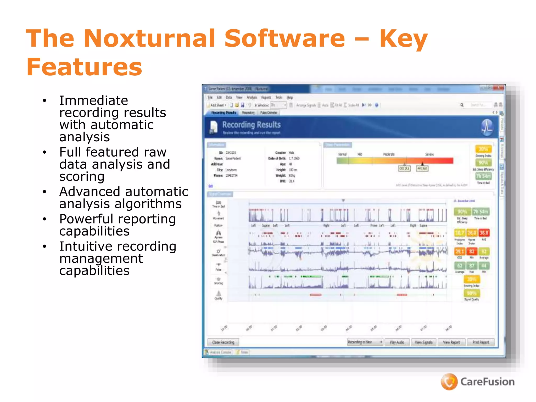 Nox t3 complete review final | PPTX