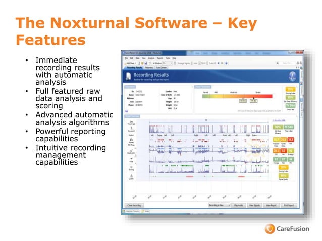 Nox t3 complete review final | PPTX
