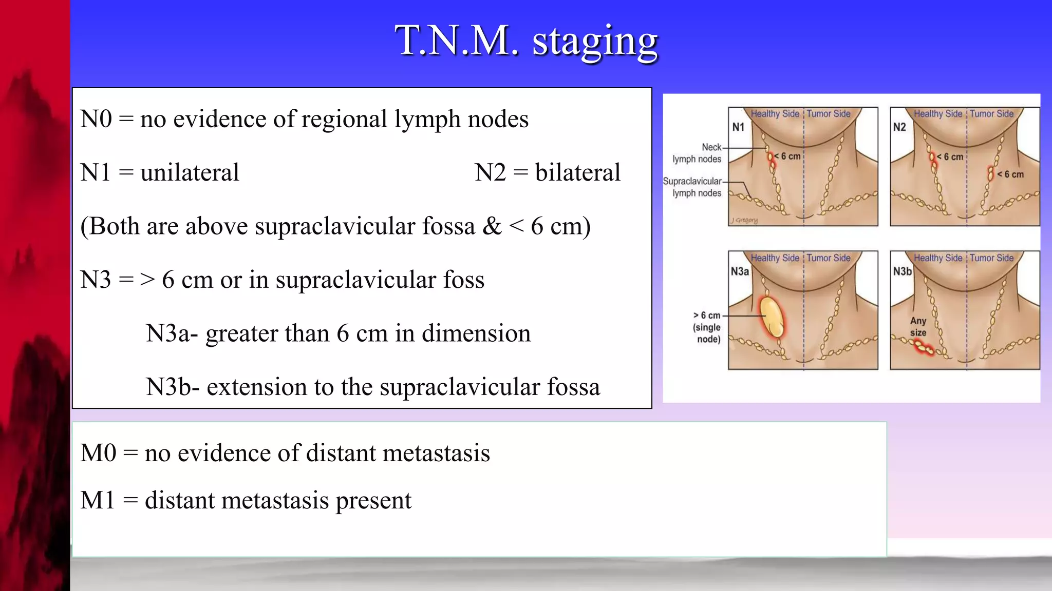 NASOPHARYNGEAL CARCINOMA | PPTX