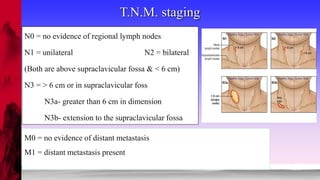 Nasopharyngeal Carcinoma Staging