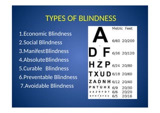 National Programme of Control of Blindness & Visual impairment | PPTX