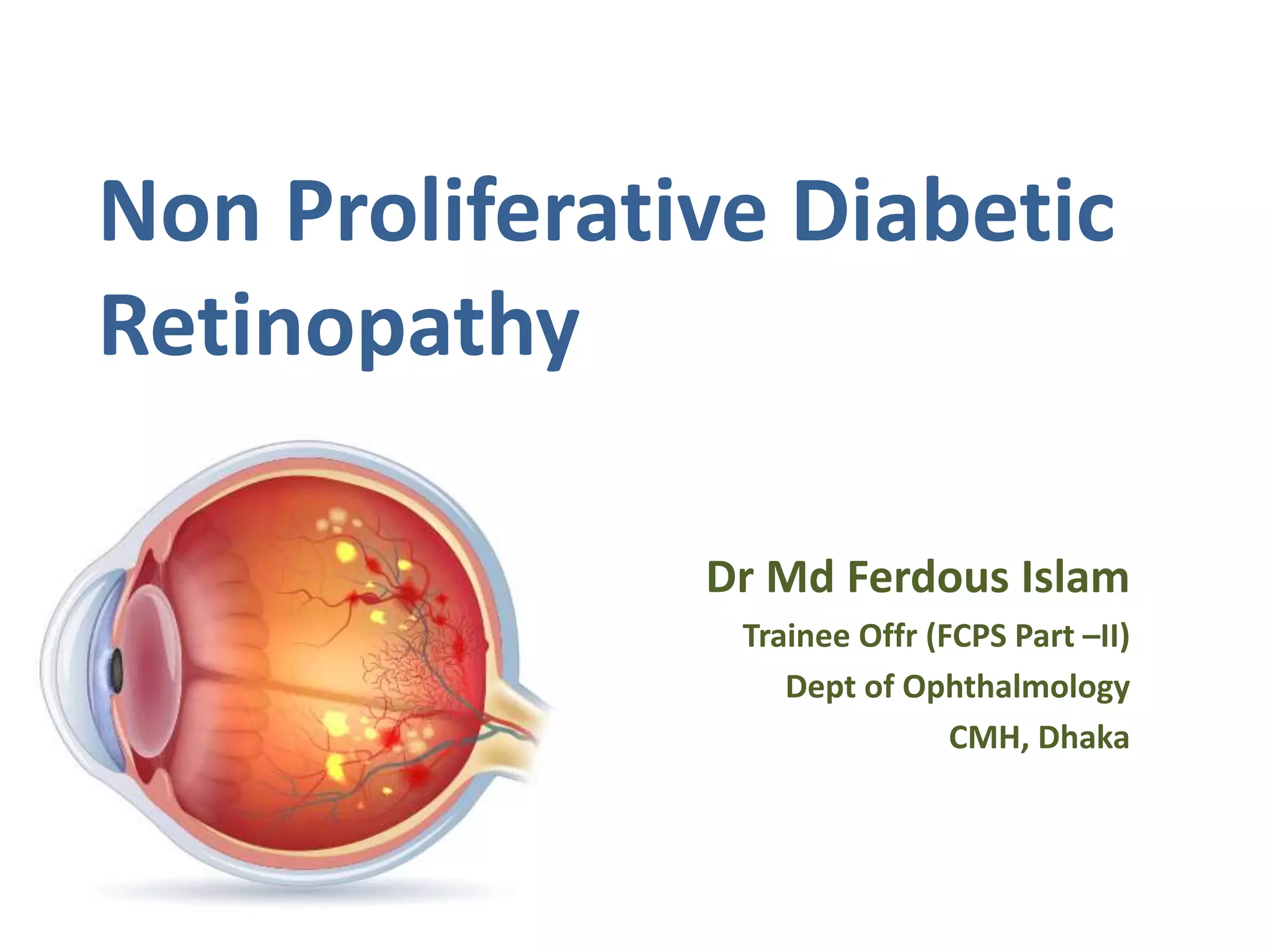 Non Proliferative Diabetic Retinopathy | PPTX