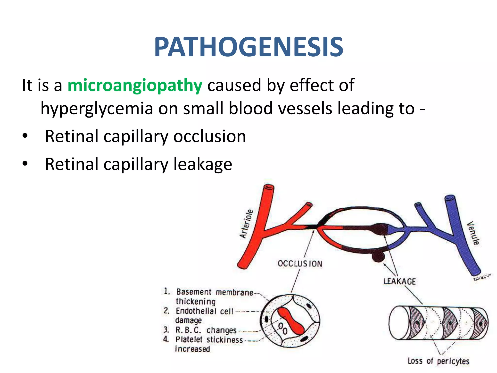 Non Proliferative Diabetic Retinopathy | PPTX