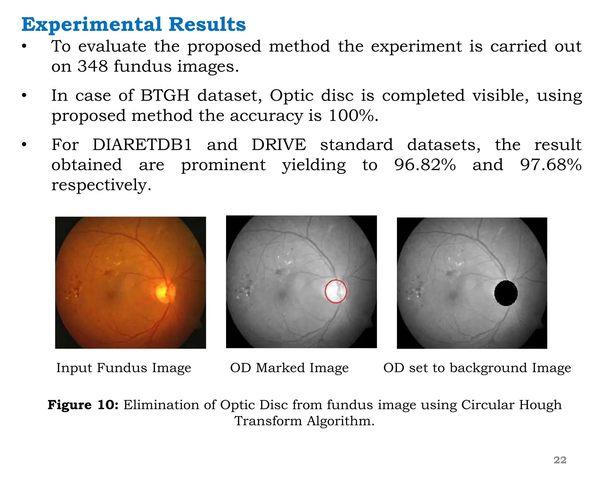 DIABETIC RETINOPATHY FROM FUNDUS IMAGES_VIVA VOCE_MSA.pptx