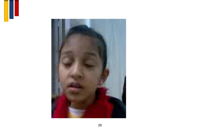 non-epileptic paroxysmal events in childern | PDF | Brain and Nervous ...