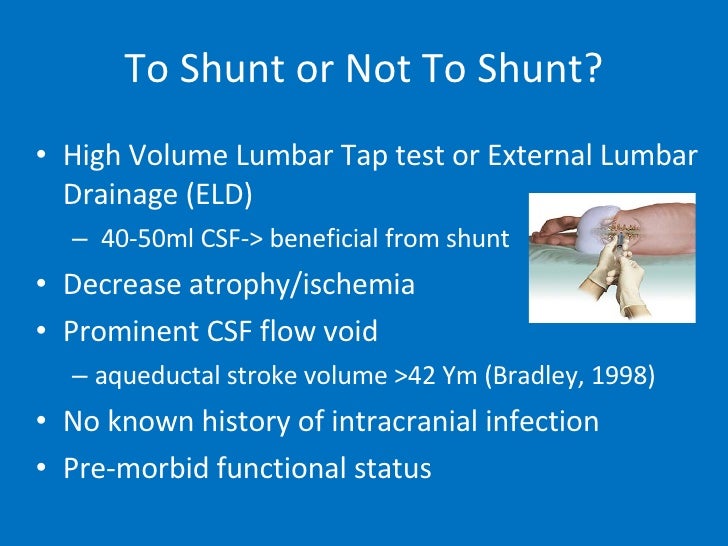 Normal Pressure Hydrocephalus