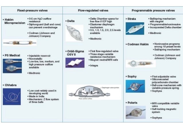 Surgical management of NPH