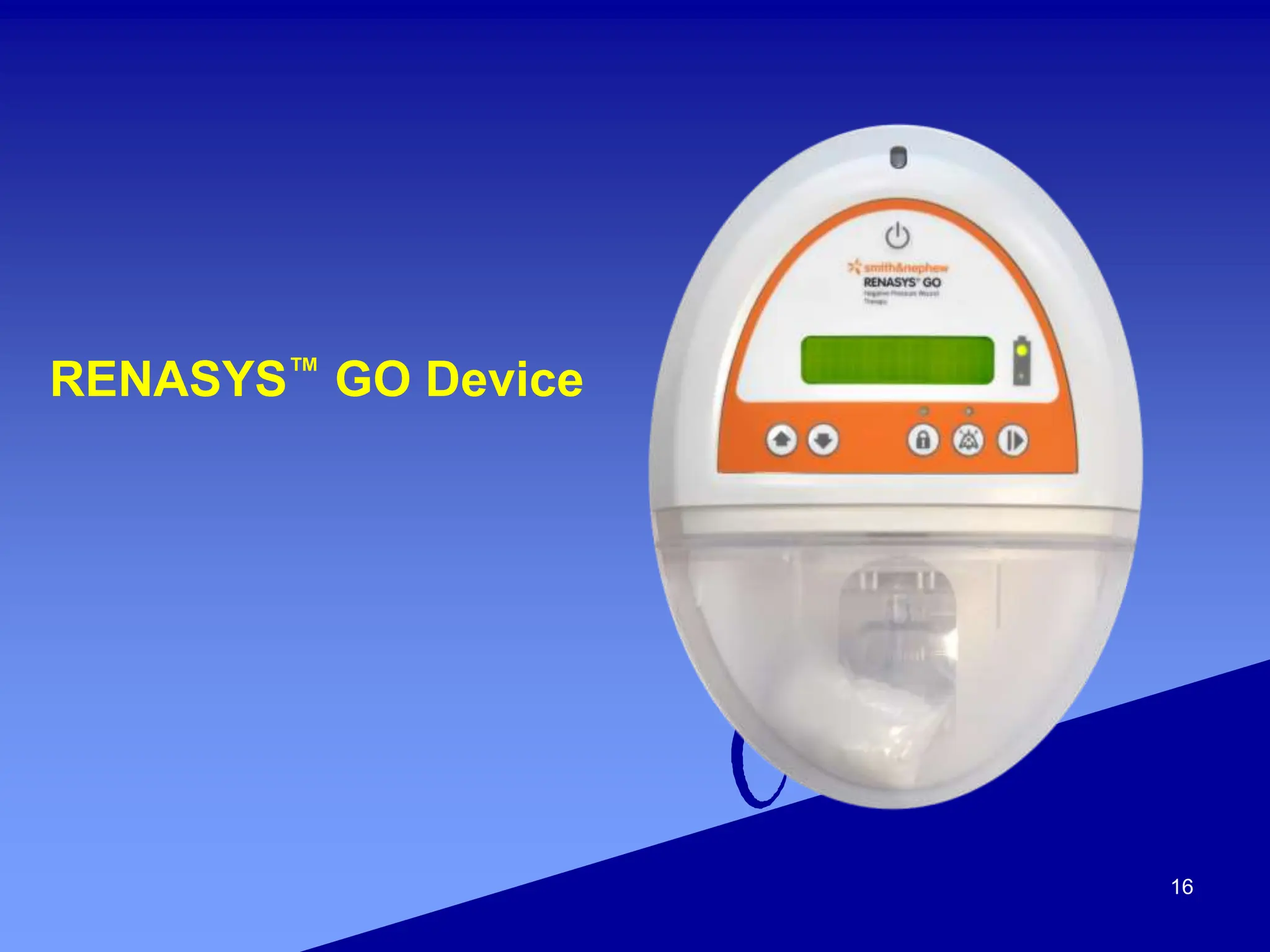 NEGATIVE PRESSURE WOUND THERAPHY METODE UNTUK PENANGANAN LUKA | PPTX