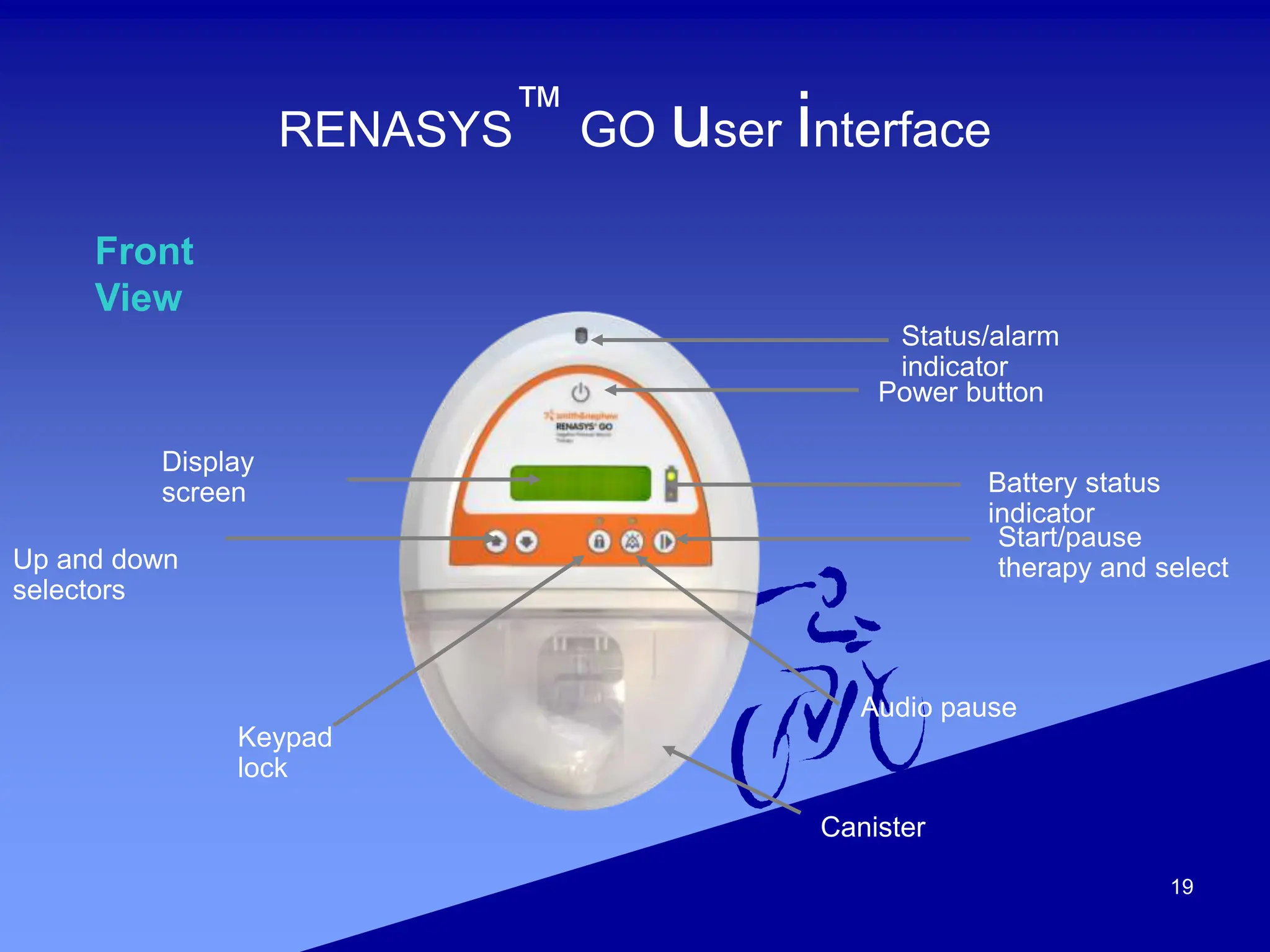 NEGATIVE PRESSURE WOUND THERAPHY METODE UNTUK PENANGANAN LUKA | PPTX