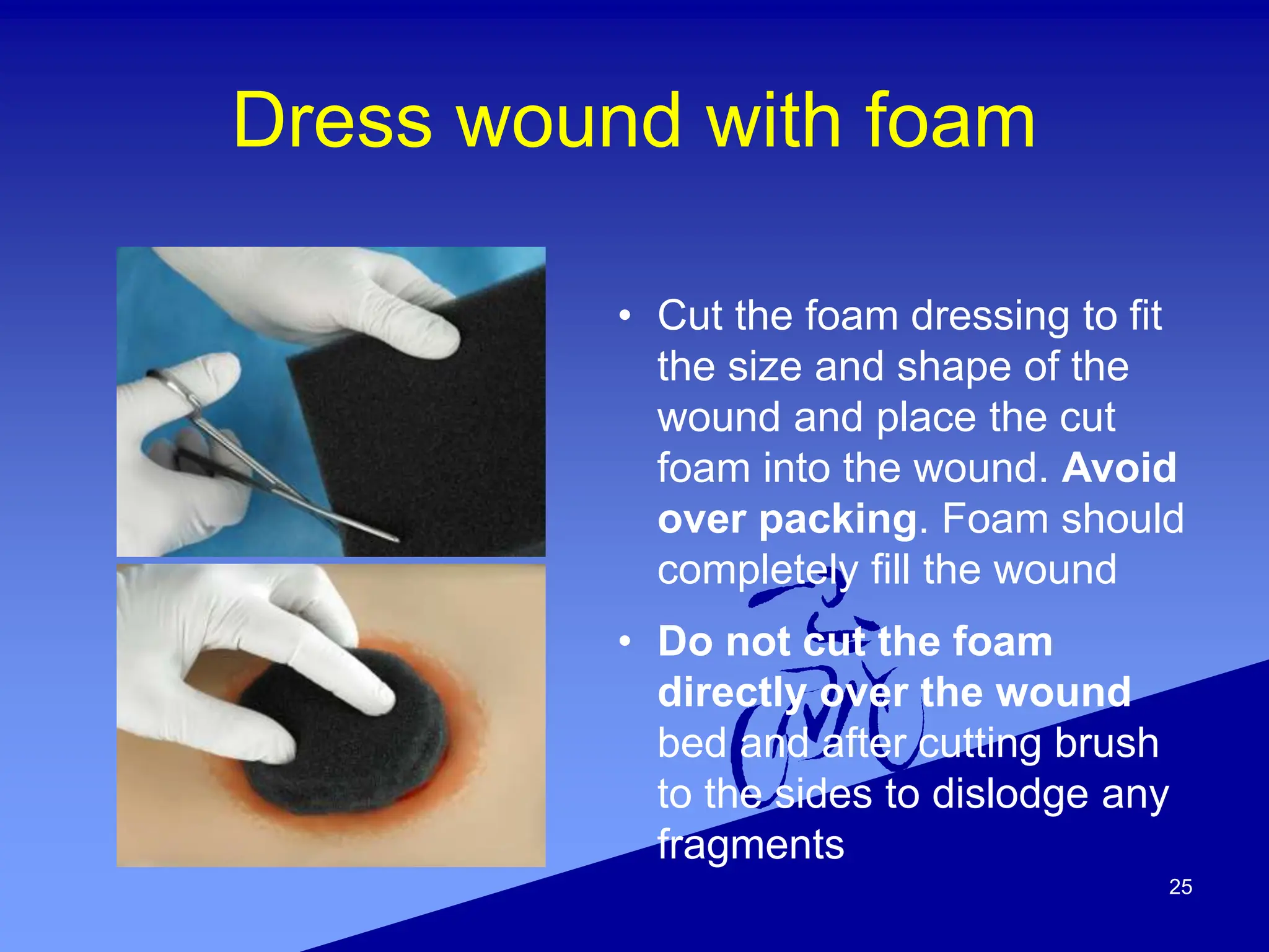 NEGATIVE PRESSURE WOUND THERAPHY METODE UNTUK PENANGANAN LUKA | PPTX