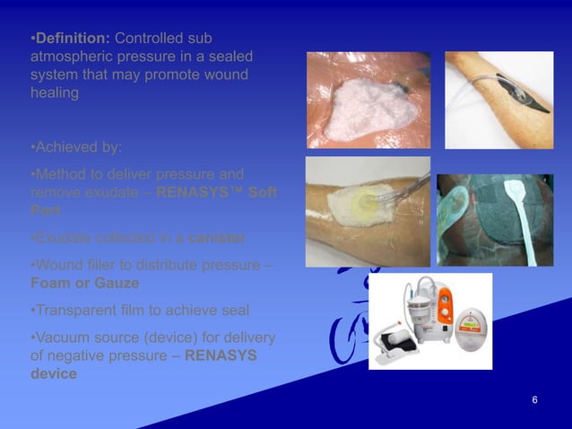 NEGATIVE PRESSURE WOUND THERAPHY METODE UNTUK PENANGANAN LUKA | PPT