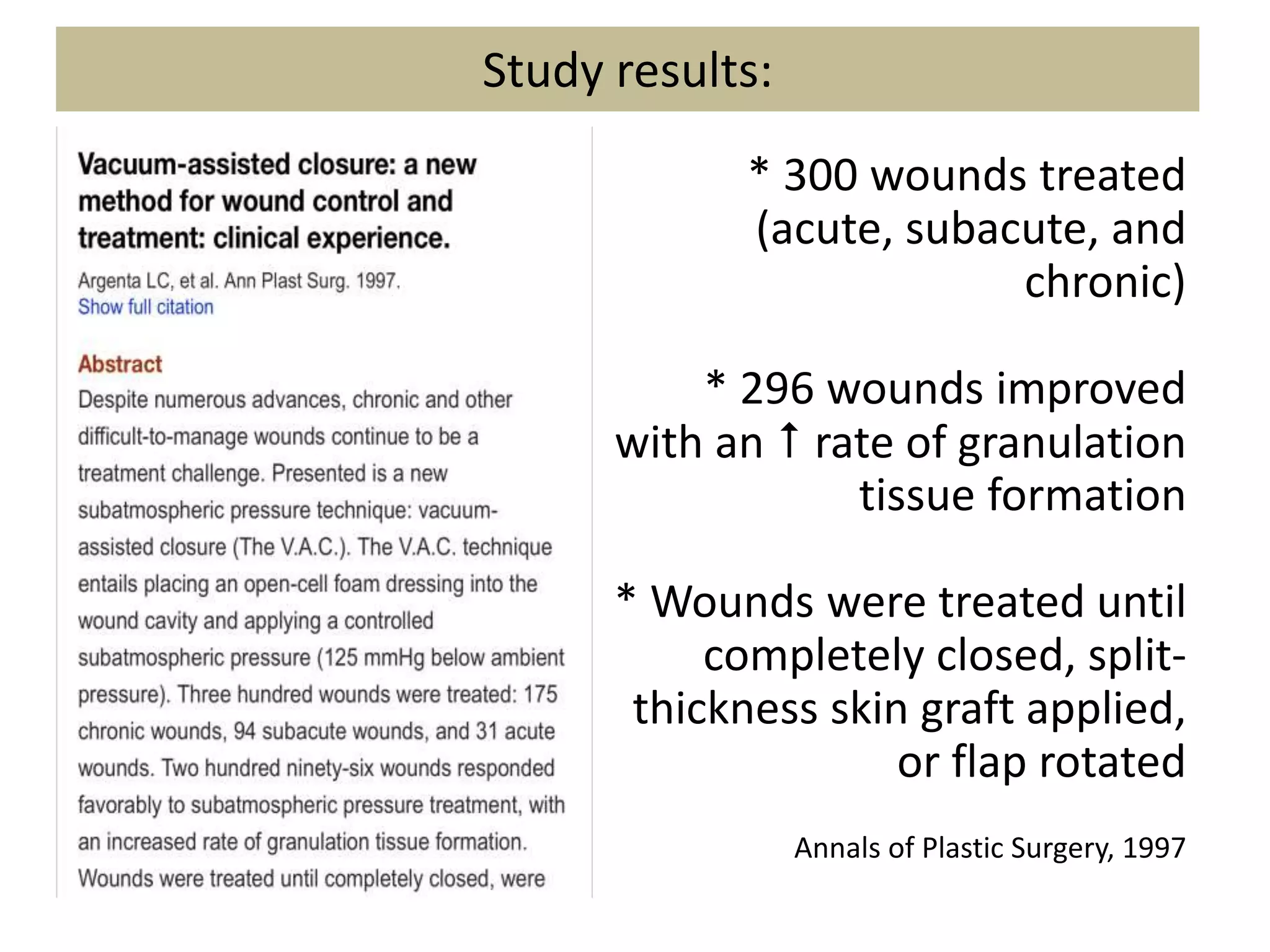 Update on negative pressure wound therapy for venous leg ulcer | PPTX