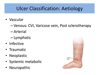 Update on negative pressure wound therapy for venous leg ulcer | PPT