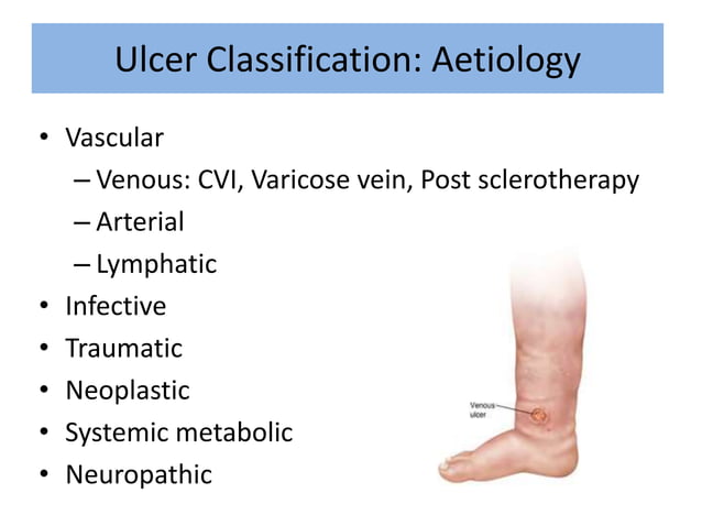 Update on negative pressure wound therapy for venous leg ulcer | PPT