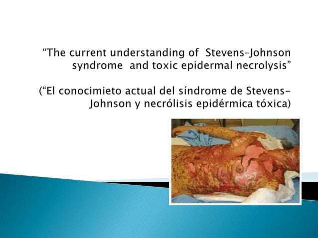 “El conocimieto actual del síndrome de Stevens-Johnson y necrólisis epidérmica tóxica | PPTX
