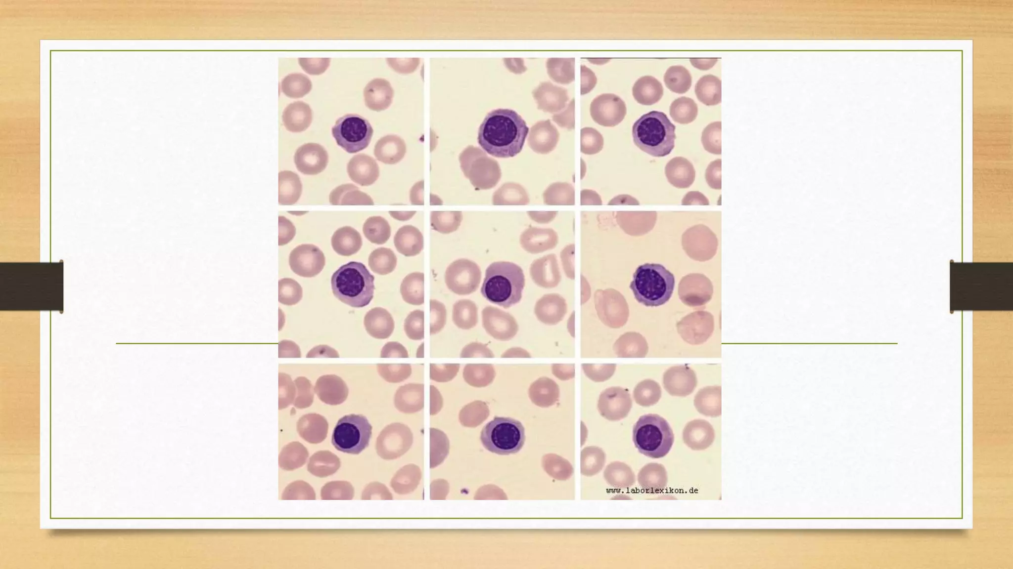NRBC - Nucleated Red Blood Cells | PPTX NRBC - Nucleated Red Blood Cells | PPTX