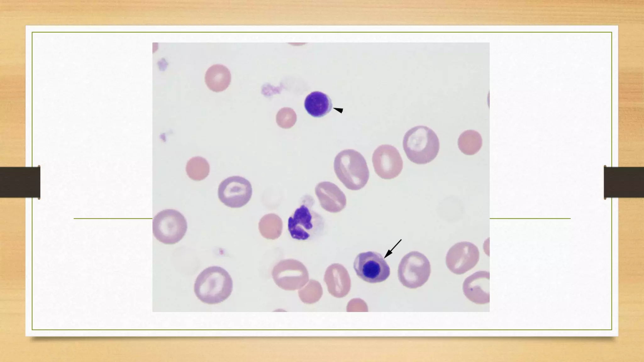NRBC - Nucleated Red Blood Cells | PPTX