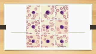 NRBC - Nucleated Red Blood Cells | PPTX